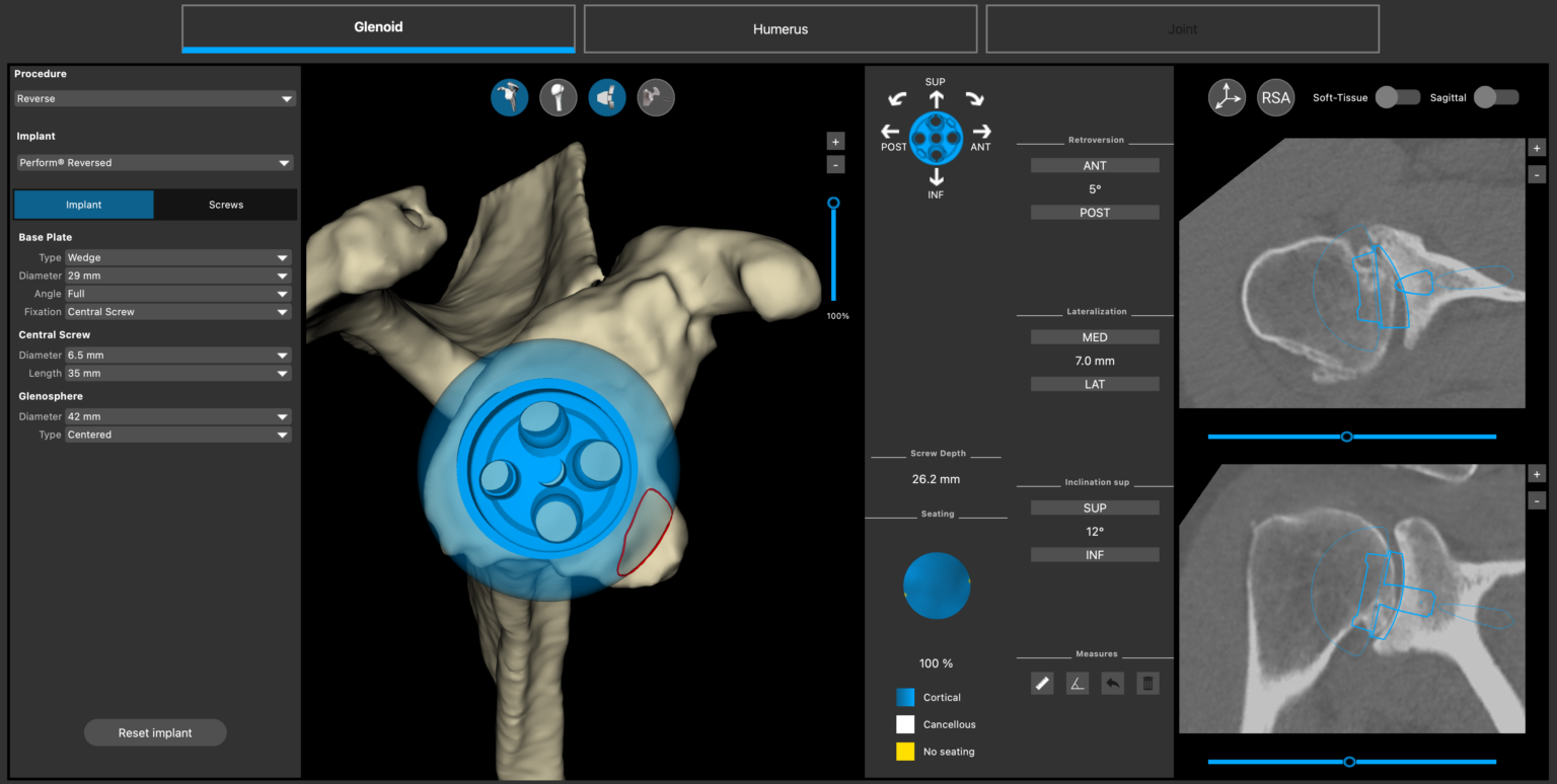 Surgery - Robotic Shoulder Doc